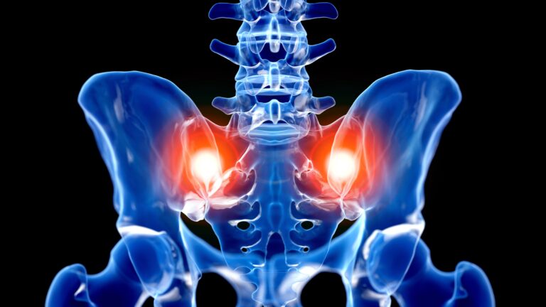 Sacroiliac Joint Injections - Restorative Pain Management